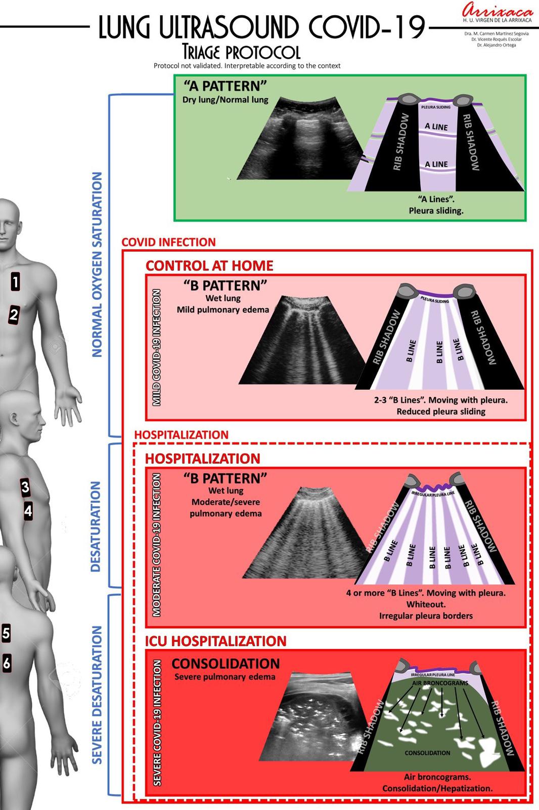 ARDS protocols – SimVA
