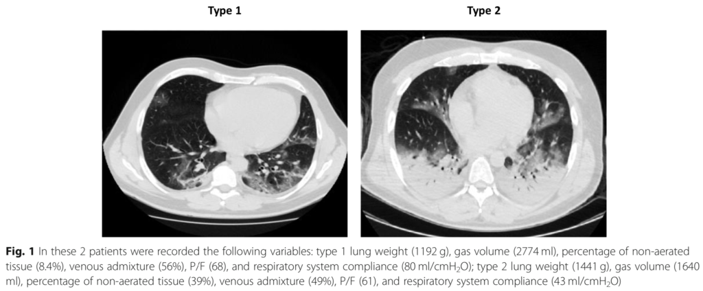 ARDS protocols – SimVA